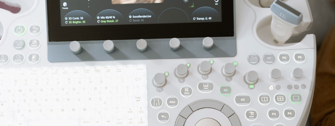 Ecocardiogramma Transesofageo - ArsbioMedica