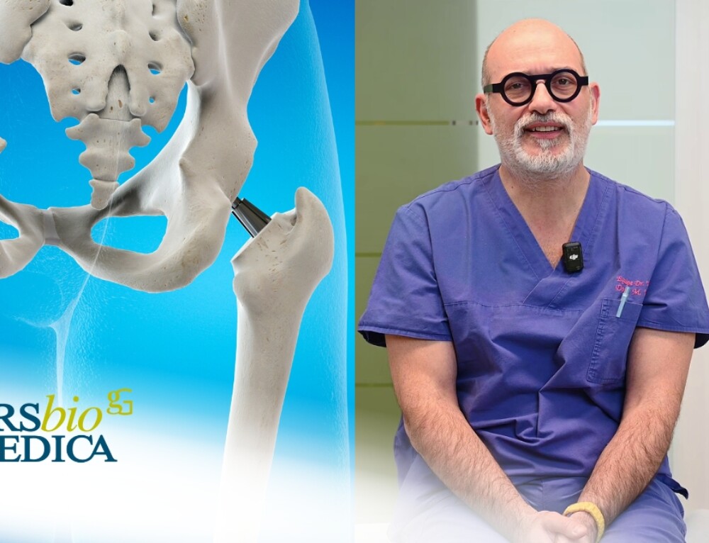 Holep prostata- Arsbiomedica